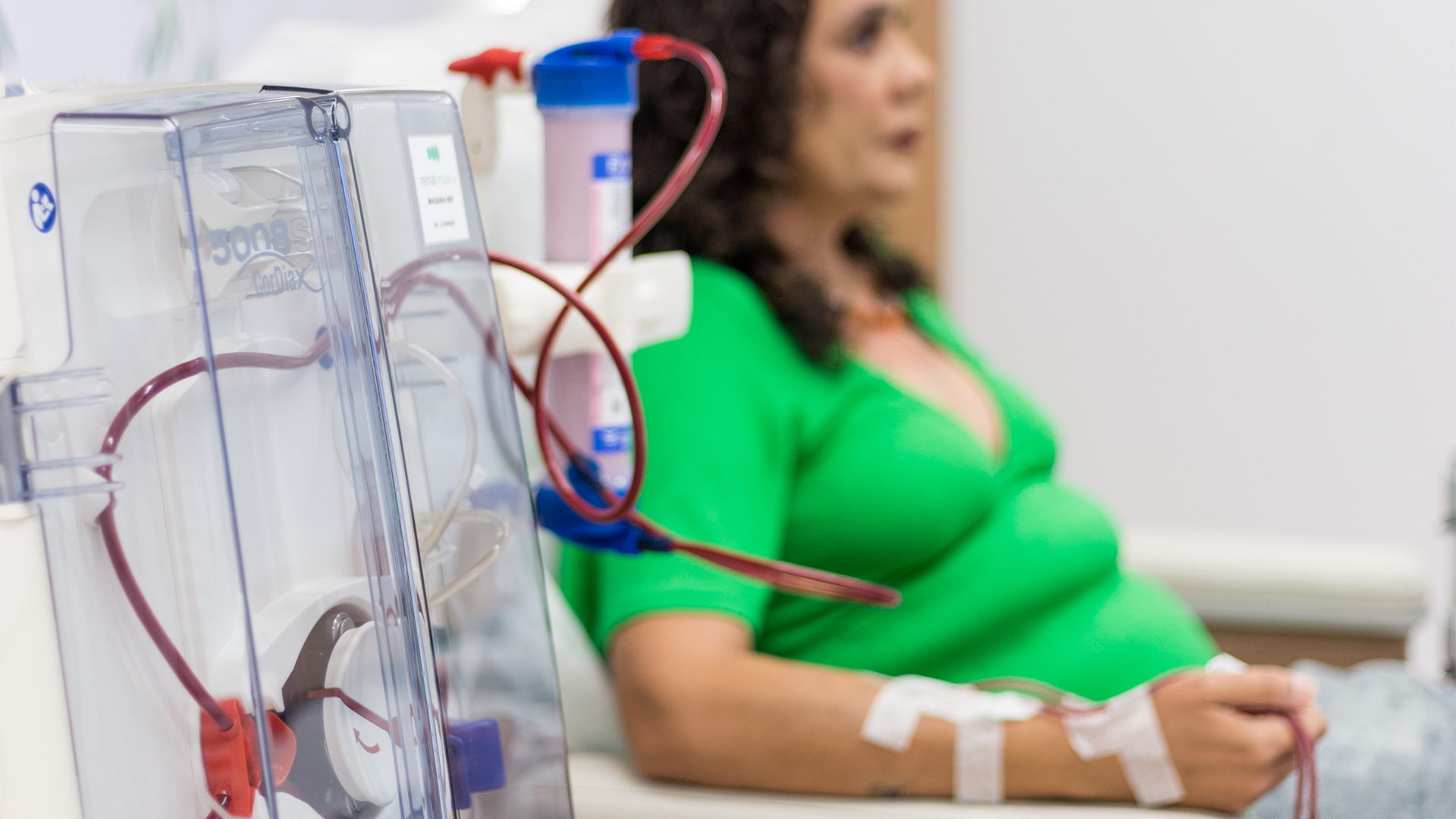 O que é hemodiálise? Entenda o tratamento e seu papel na saúde renal ...